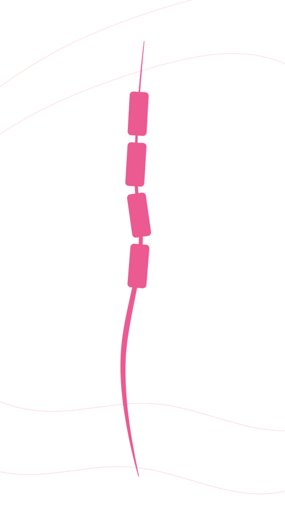 Gynefix spiraal - Anticonceptie