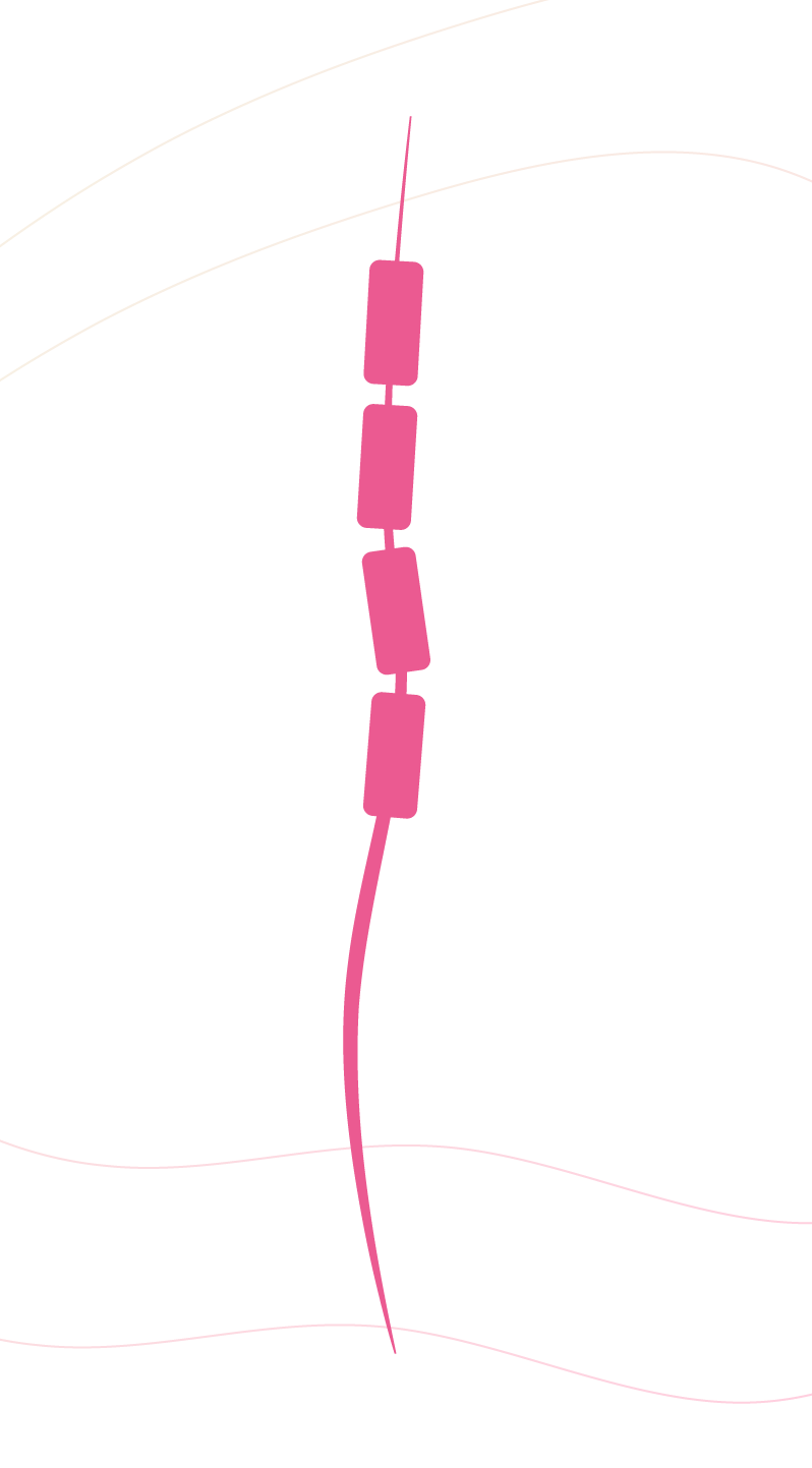 Gynefix spiraal - Anticonceptie